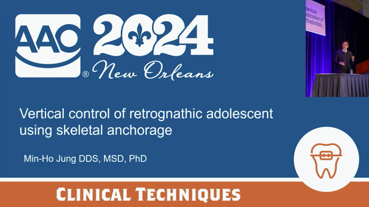 Vertical Control of Retrognathic Adolescents using Skeletal Anchorage ...