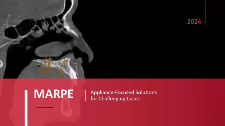 Supplier: Essentials of Marpe Design from Partners Dental Studio ...