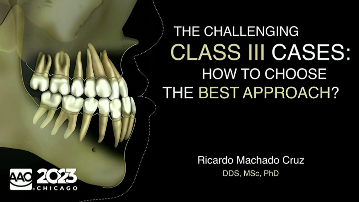 Challenging Class III Cases: How to Choose the Best Approach - American ...