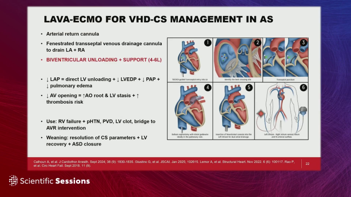 Beyond the Usual Suspects: Atypical Causes of Shock in the CICU - AHA ...