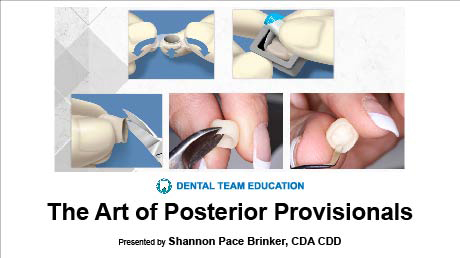 The Art of Posterior Provisionals (Dental Team Education) - American ...