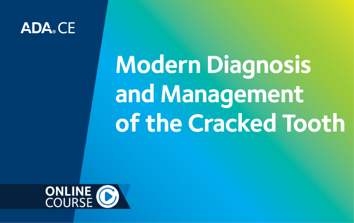 Modern Diagnosis and Management of the Cracked Tooth (2026 CDT Codes ...
