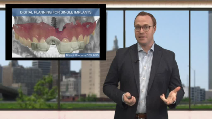 Digital Planning for Single Implants - American Dental Association