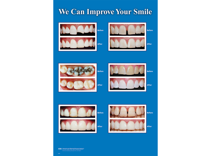 24" x 36" Unframed Wall Art, Improve Your Smile - American Dental ...