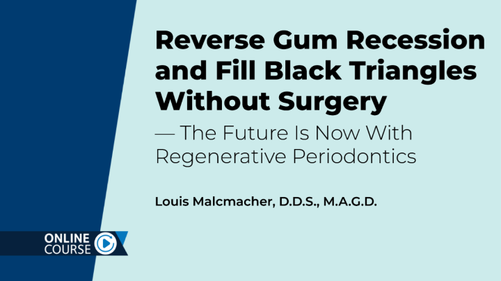 Reverse Gum Recession and Fill Black Triangles Without Surgery: The ...