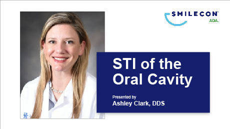 STI of the Oral Cavity - American Dental Association