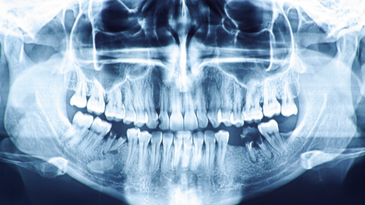 ADA Clinical Recommendations: Optimizing Radiation Safety in Dentistry ...