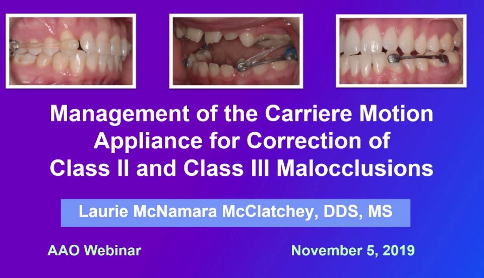 2019 Webinar - Management of the Carriere Motion Appliance Prior to ...
