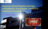 2016 AAO Annual Session - Demineralized Lesions During Orthodontic ...