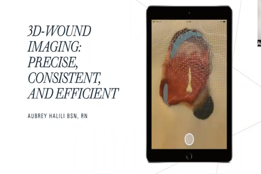 3D-Wound Technology: Precise, Consistent, and Efficient - American ...