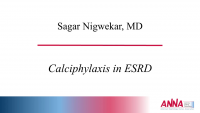 Calciphylaxis in ESRD - American Nephrology Nurses Association