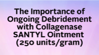 The Importance of Ongoing Debridement with Collagenase SANTYL Ointment ...
