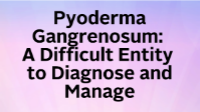 Pyoderma Gangrenosum: A Difficult Entity to Diagnose and Manage - Wound ...