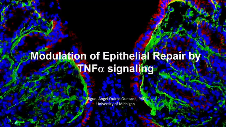 AGA Novel Players and Mechanisms of Epithelial Repair During Mucosal ...