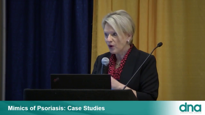 Mimics of Psoriasis: Case Studies - Dermatology Nurses' Association