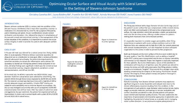 2 - Optimizing Ocular Surface and Visual Acuity with Scleral Lenses in ...