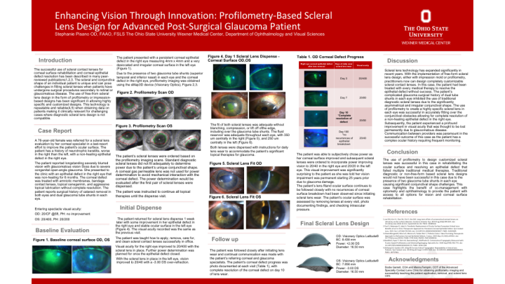 110 - Enhancing Vision Through Innovation: Profilometry-Based Scleral Lens Design for Advanced ...