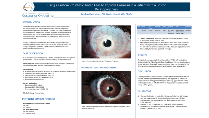 86 - Using a Custom Prosthetic Tinted Lens to Improve Cosmesis in a ...