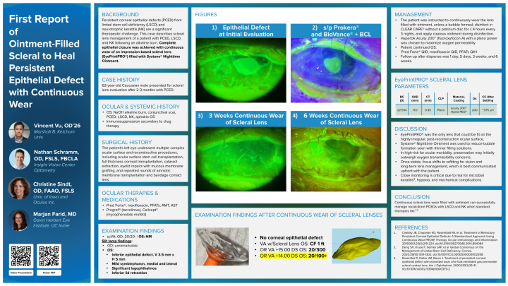 First Report of Ointment-Filled Scleral Lens to Heal Persistent ...