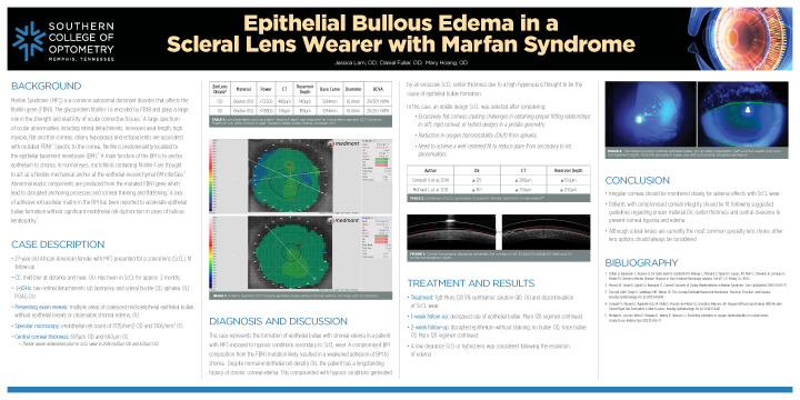 22 - Epithelial Bullous Edema in a Scleral Lens Wearer with Marfan ...