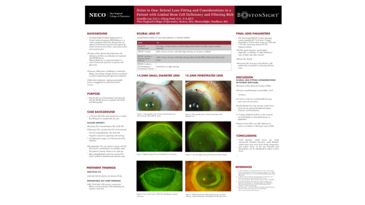 150 - Holes in One: Scleral Lens Fitting and Considerations in a ...