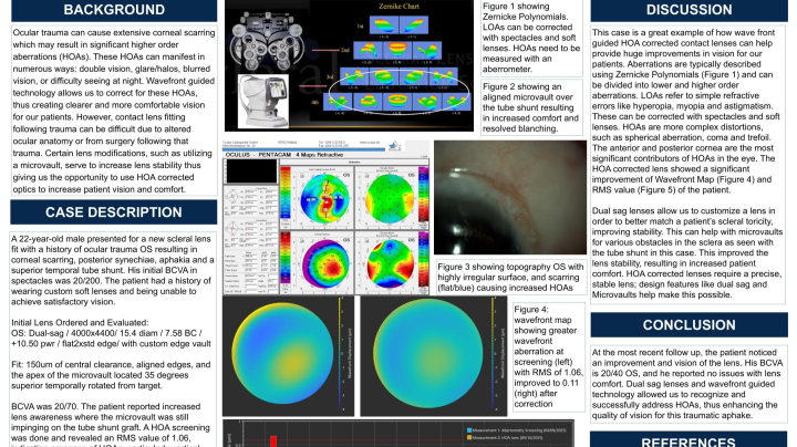 Precision Vision: HOA Corrected Dual Sagittal Scleral Lens in Traumatic ...
