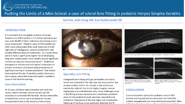 74 - Pushing the Limits of a Mini-Scleral: a Case of Scleral Lens ...