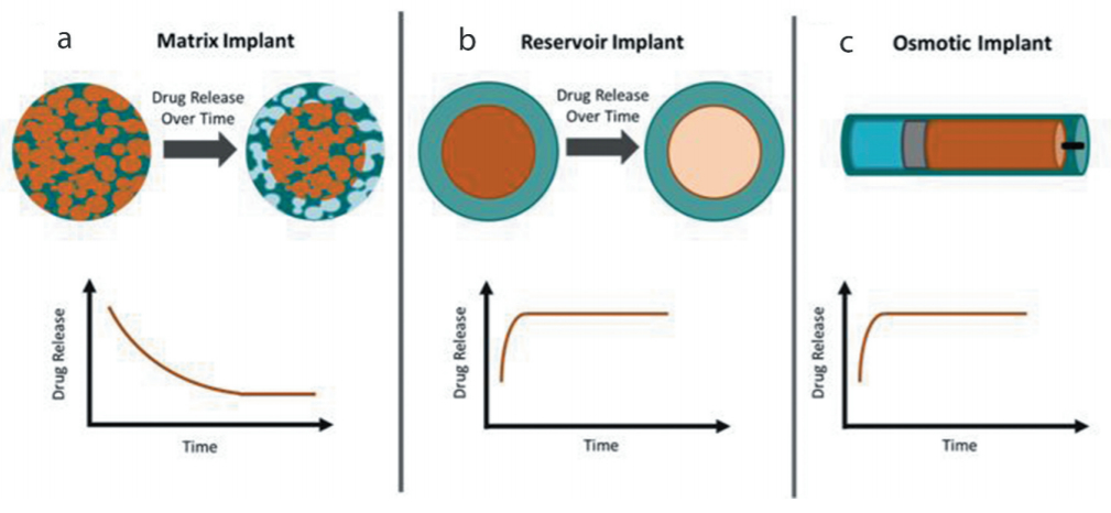 Implantable drug delivery systems: how are they designed and developed ...