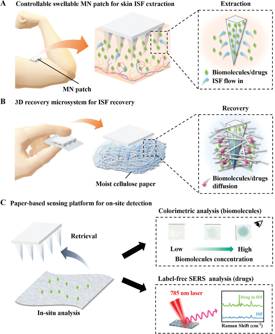 Microneedle patch assisted minimally invasive sensing system based on ...